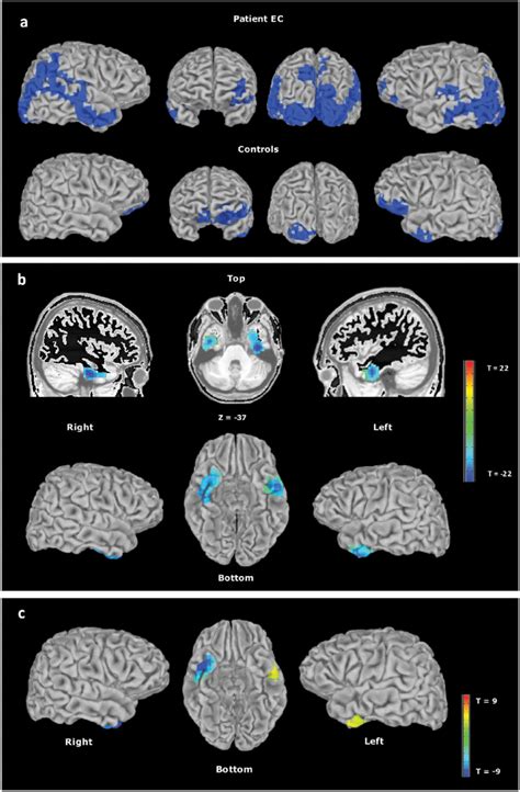 A Patterns Of Mean Functional Activation For Ec And The Control Group Download Scientific