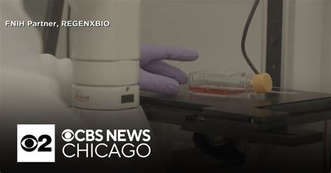 New Research Aims To Help Als Patients Doctors Cbs Chicago