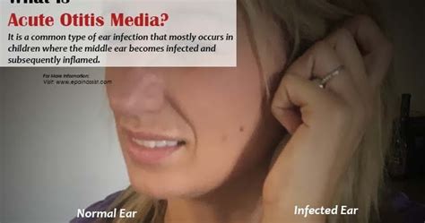 Otitis Media In Adults