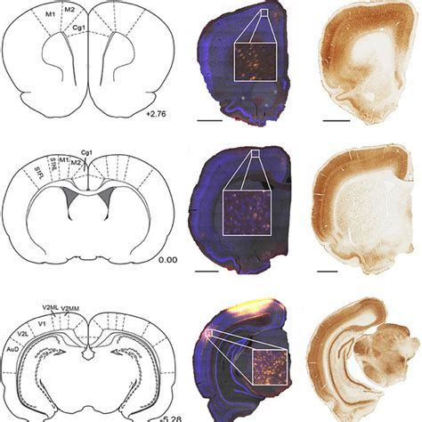 Distinct Input Patterns For Medial Vs Lateral Parietal Cortex Each