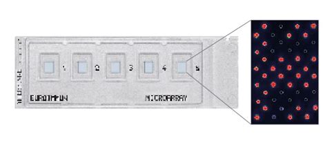 Microarray Euroimmun