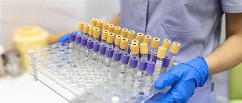 Cholera Outbreak Dont Wait For Lab Diagnosis To Treat Ngoho Media