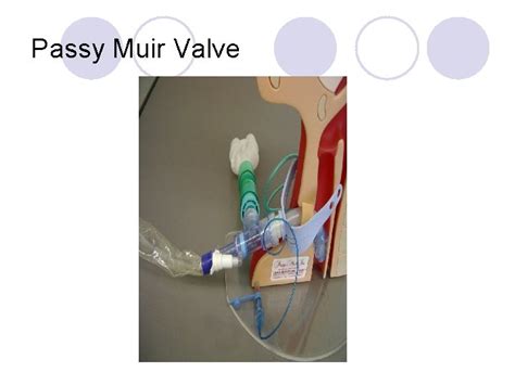 Tracheostomy Patients Are We Really Their Voice Tracheostomy