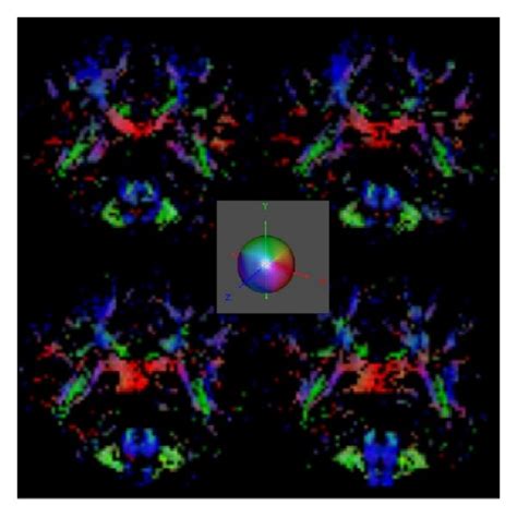 RGB Maps DEC Maps For Coronal Slices 59 60 Upper Panels And Download Scientific