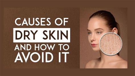 Prevent And Treat Dry Skin Naturally Easy Tips