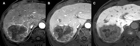 Magnetic Resonance Imaging Findings For A Representative Case Involving Download Scientific