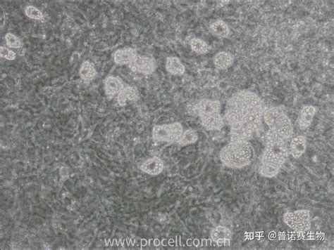 细胞学堂 3t3 L1细胞培养及成脂诱导攻略详解 知乎