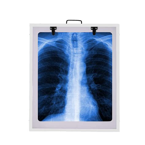 X Ray View Single 14x17 Inch White Fidelis Healthcare