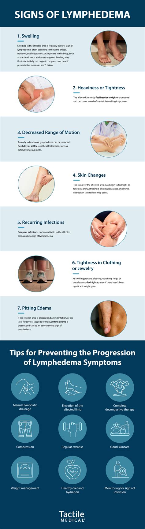 Symptoms Of Lymphedema In Abdomen Snud