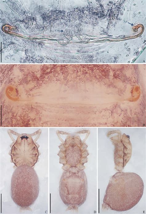 Speocera Batang Li Li Sp Nov Holotype Female A Genitalia Download Scientific Diagram