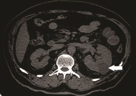 Case 6