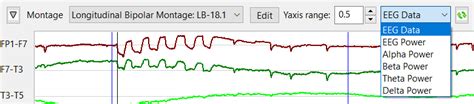 Labscribe Eeg Analysis Module Iworx Systems Inc