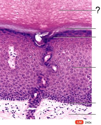 The Integumentary System Chapter 5 Workbook Exercise 7 Flashcards Quizlet