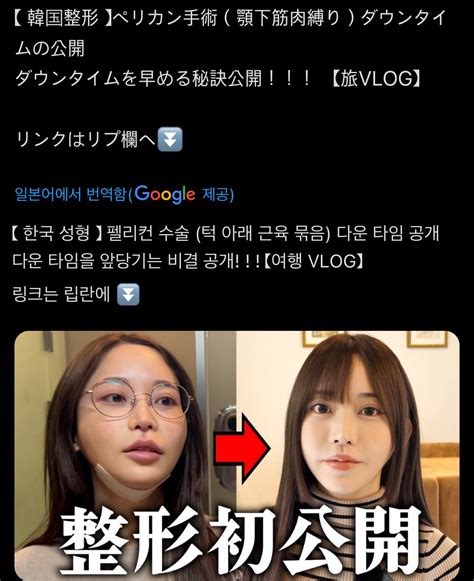 한국와서 성형수술한 Av배우 유머 움짤 이슈 에펨코리아