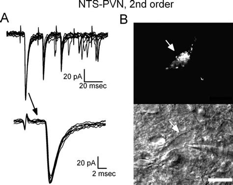 Some Pvn Projecting Nts Neurons Display Low Jitter St Epsc Responses