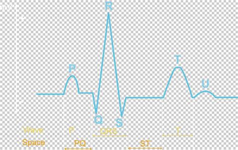 Normální Vektor Ekg
