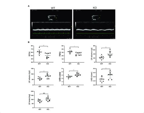 Mavs Deletion Leads To Left Ventricular Dilation And Systolic