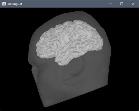 CAT12 Segmentation Error Bugs Brainstorm