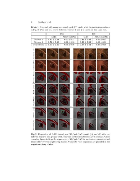 Foldit Haustral Folds Detection And Segmentation In Colonoscopy Videos Deepai