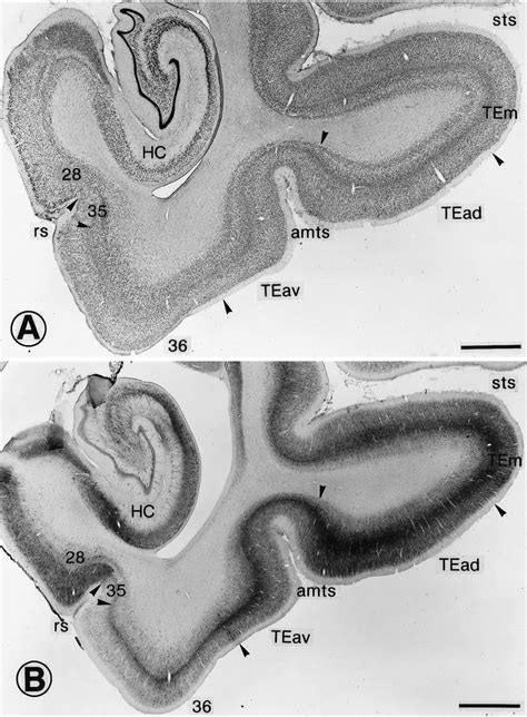 Rhinal Cortex Sectioned View