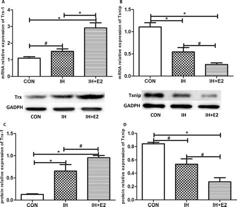 Estradiol Increased Trx 1 And Reduced Txnip Expressions A The Mrna
