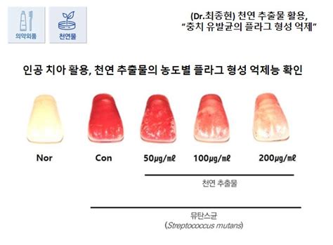2022 천연 추출물 활용 충치 유발균의 플라그 형성 억제” 사업화 유망기술 Kribb 바이오기술장터