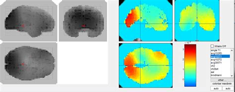 Export To Spm Erroneous Coordinates Of Origin In Nifti Output File Bugs Brainstorm