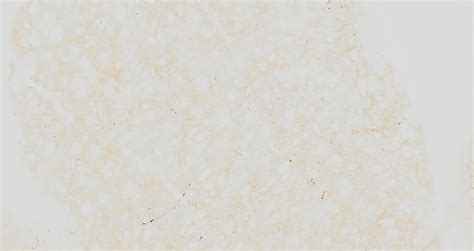 Automated Counting In Ihc Dab Staining Image Analysis Imagesc Forum