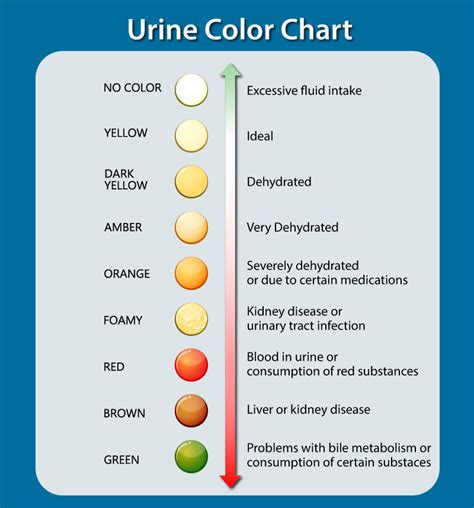 Abnormal Urine Color Chart What Color Is Your Urine Uci Health