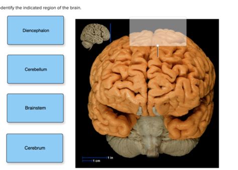 LAB 3 Flashcards Quizlet
