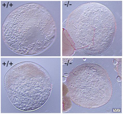 No Significant Difference Was Observed In The Comparison Of Mature