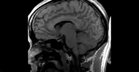 Indian And Australian Scientists Develop Artificial Synapse For Brain