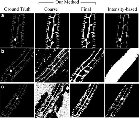Dendritic Tree Segmentations A C Three Example Mip Images Download Scientific Diagram