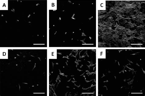 Figure 1 From Advanced Functional Materials Based On Nanocellulose For