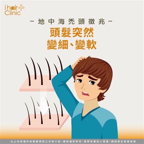地中海禿頭徵兆有哪些若是發現4個現象就要小心 Ihair風華御髮