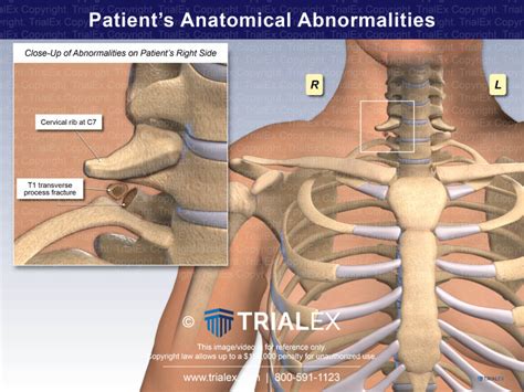 Patients Anatomical Abnormalities Trialquest Inc