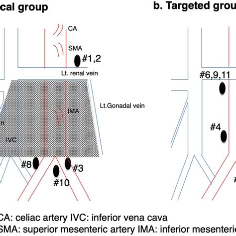 A The Site Of Lymph Node Recurrence After Palm Resection In Radical Download Scientific Diagram