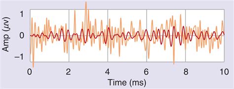 王小桃带你读文献：噪声与失真——信号与噪声 Noise And Distortion Part I 知乎
