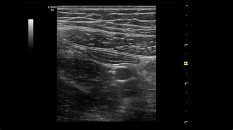 Ultrasound Nadkarnis Training Academy Gujarat Vapi