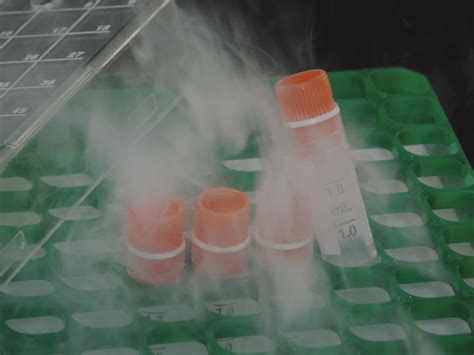 Lab Labeling Essentials Best Practices For Labeling Specimens Tubewriter 400