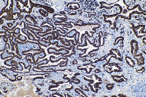 Cytokeratin 7 Antibody 68296 1 Ig Proteintech