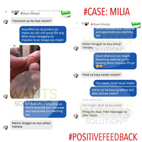 Warts Solution Ph Cebu City