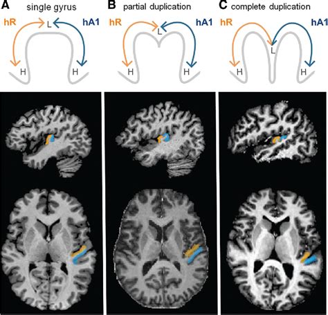 Primary Auditory Cortex Semantic Scholar