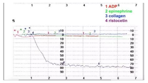 Platelet Function Tests Pptx