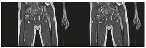 Magnetic Resonance Imaging Mri In 2019 There Were Multiple