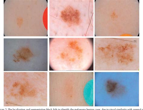 Figure 1 From A Novel Region Extreme Convolutional Neural Network For