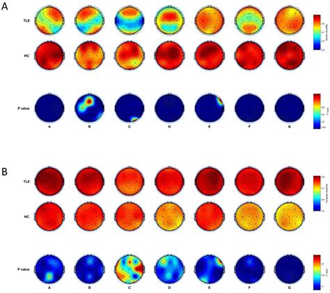 Figure 5 From Microstate Based Brain Network Dynamics Distinguishing
