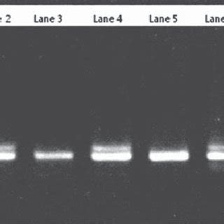 A Gel Electrophoresis Of Sex Specific PCR Products For Sex Download Scientific Diagram