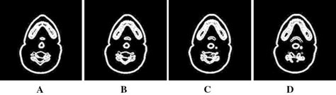 phase field segmented results of a human head ct a d corresponds to