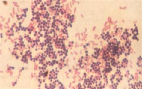 Bact Pracs Flashcards Quizlet